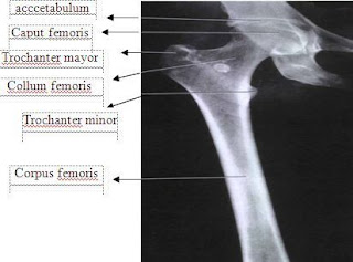 PENGERTIAN RADIOGRAFI | Hidupsehat