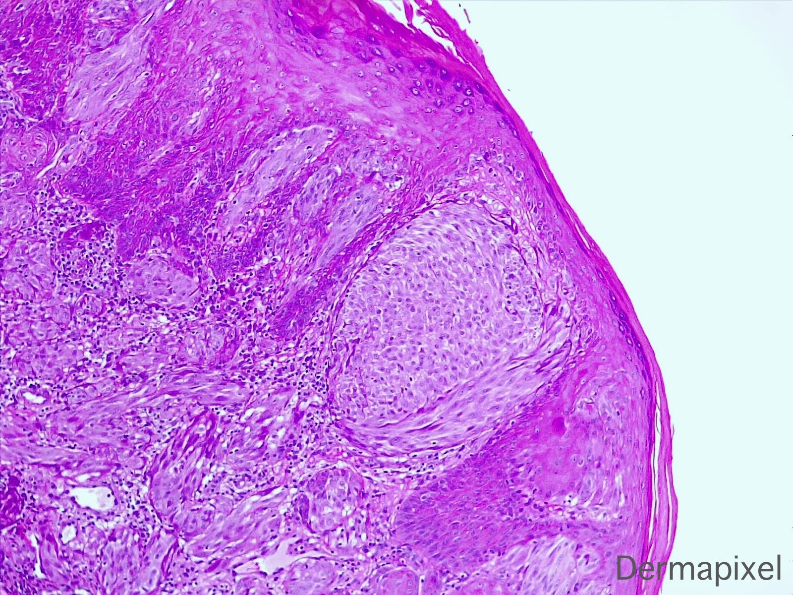 Dermapixel: enero 2021