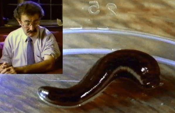 Embryology in the Qur’ān: External appearance of the embryo as a Leech