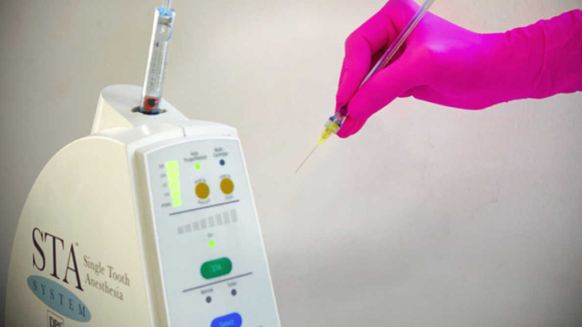 Anestesia Digital en Odontologia