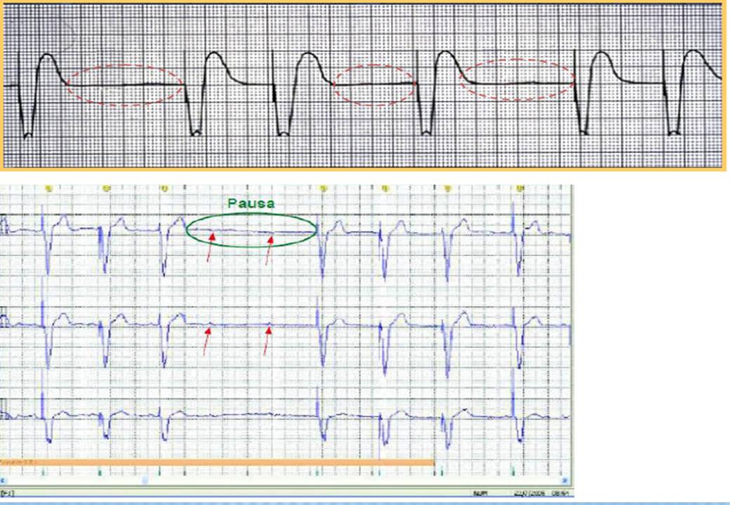 Núcleo de Estudos em Cardiologia on line (Cardios On line): Alterações ...