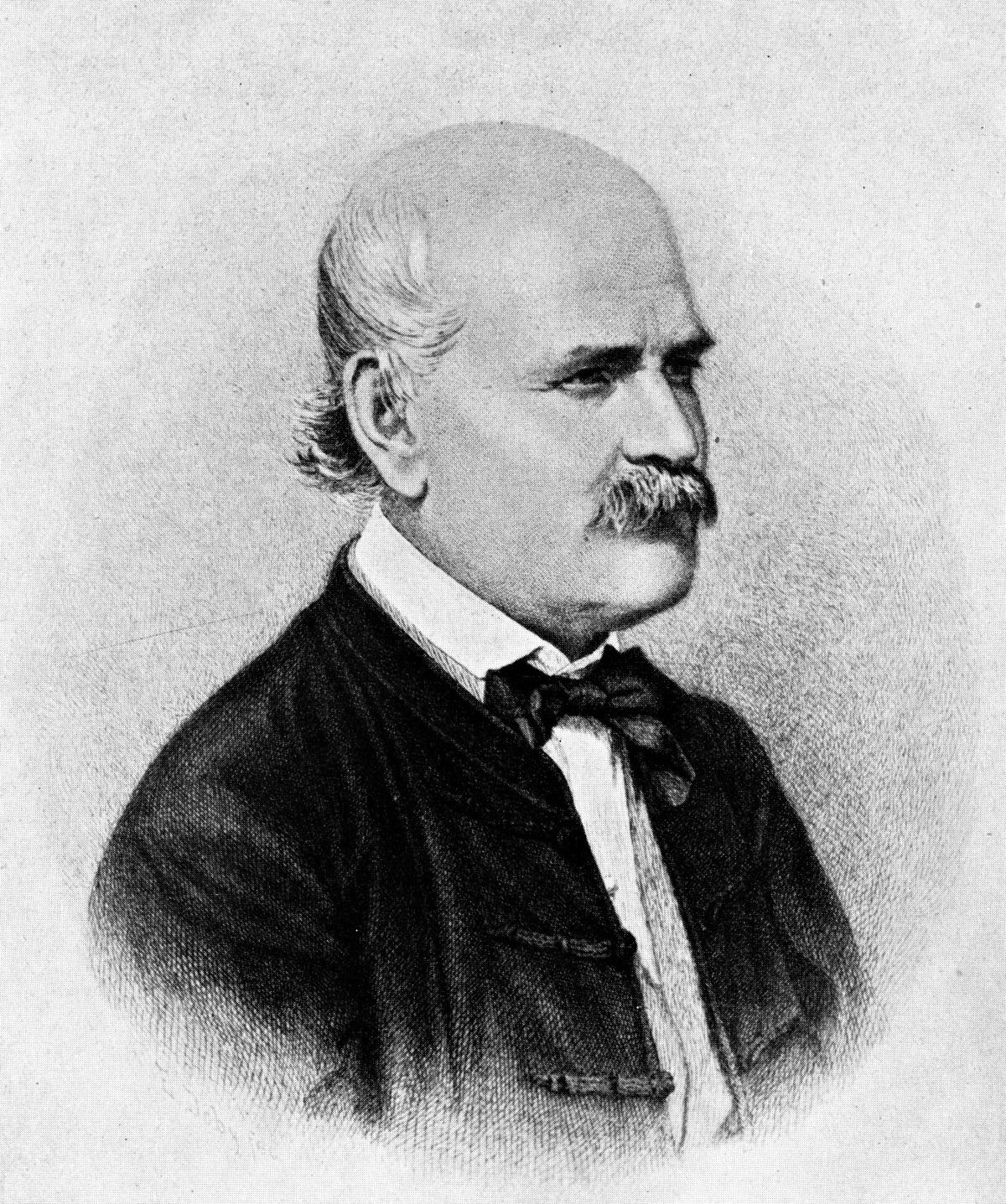 El caso Semmelweis