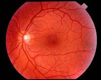 Pourquoi a t-on les yeux rouges sur certaines photos? ~ Général Kulture!