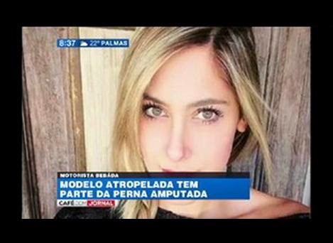 Modelo que teve a perna amputada passa por nova cirurgia