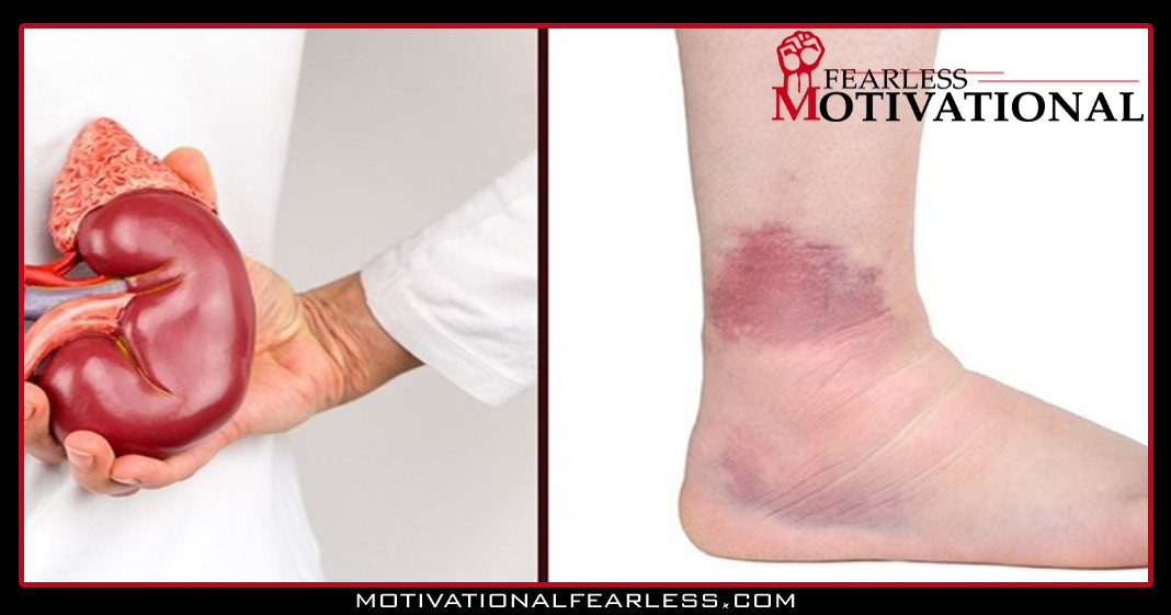 17 symptoms of a tired and unhealthy kidney - Motivational Fearless