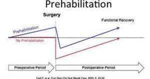 What is “Prehab’”?? And how to properly prepare for an elective surgery ...