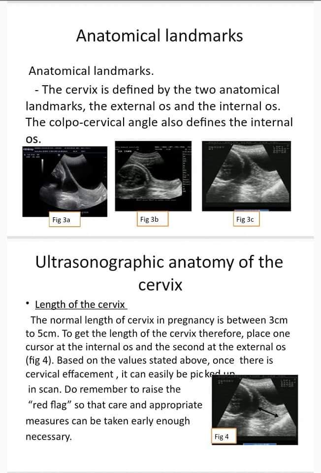 Cervical Incompetence - Health and Nutrition