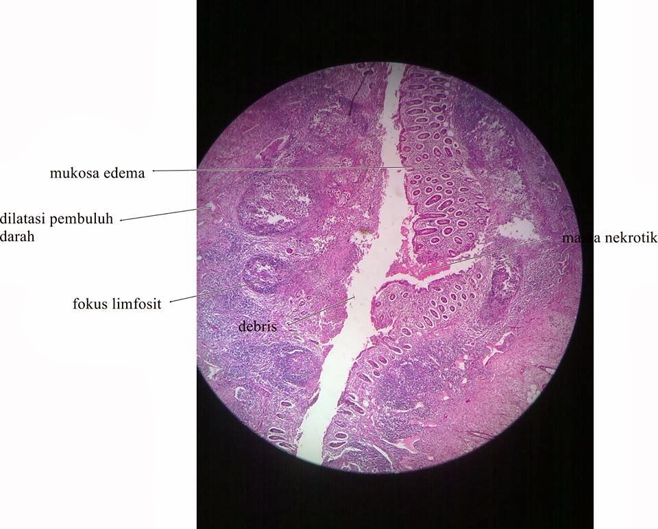 Doctor Wanna Be: patologi anatomi saluran cerna