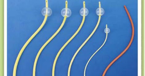 Prosedur Irigasi Kateter