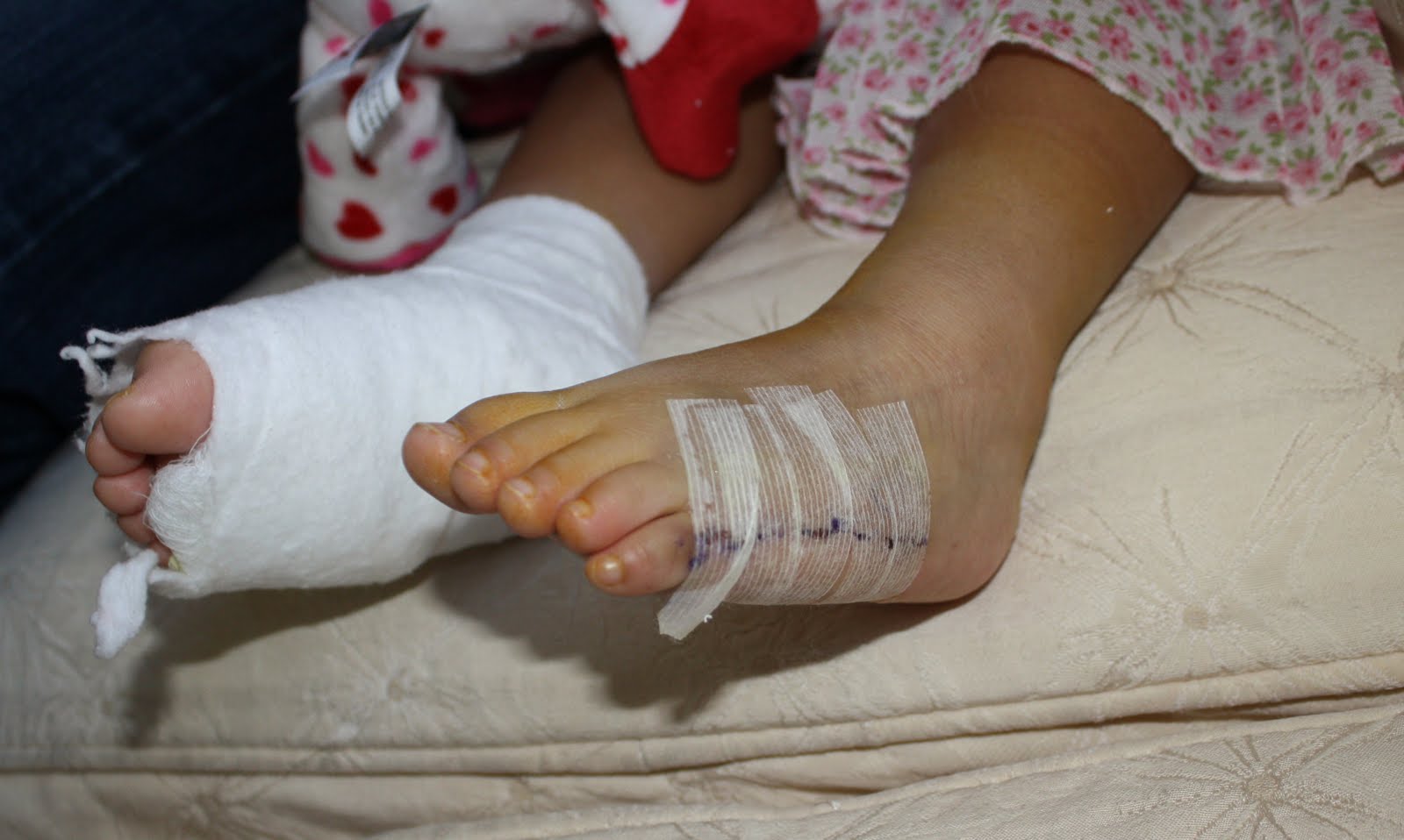 The Joy of Georgea: Bye-Bye Foot Casts, 1-23-11