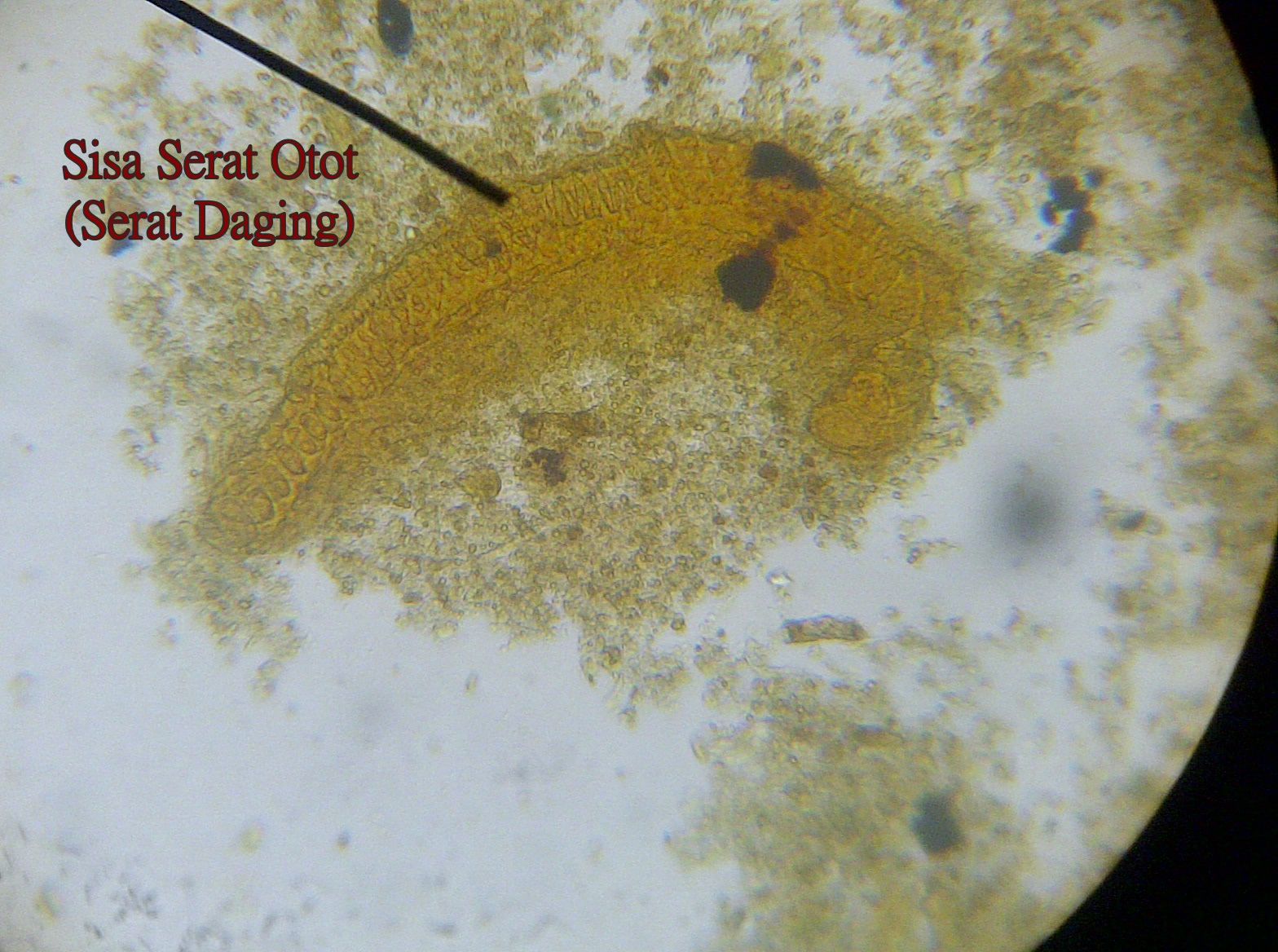 Rizqi Murtafi'ah: Pemeriksaan Feses Lengkap