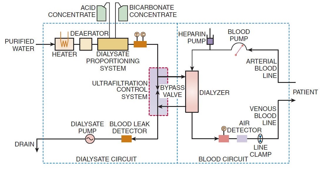 DIALYSIS MACHINE - DIALYSATE DELIVERY SYSTEM.
