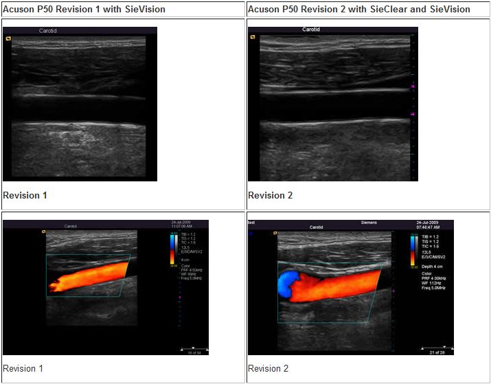 Selling New and Used Medical Equipment: Portable Ultrasound Machine ...