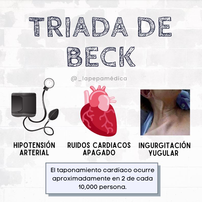 LA PEPA MÉDICA: Triada de Beck