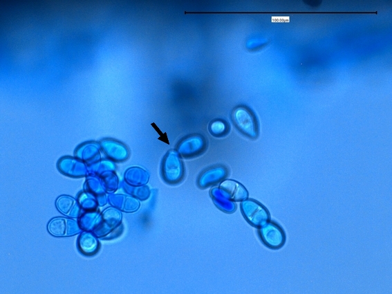 Fun With Microbiology (What's Buggin' You?): Trichothecium roseum