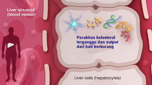 Statin, Obat Kolesterol Tinggi, Cara Kerja dan Efek Sampingnya