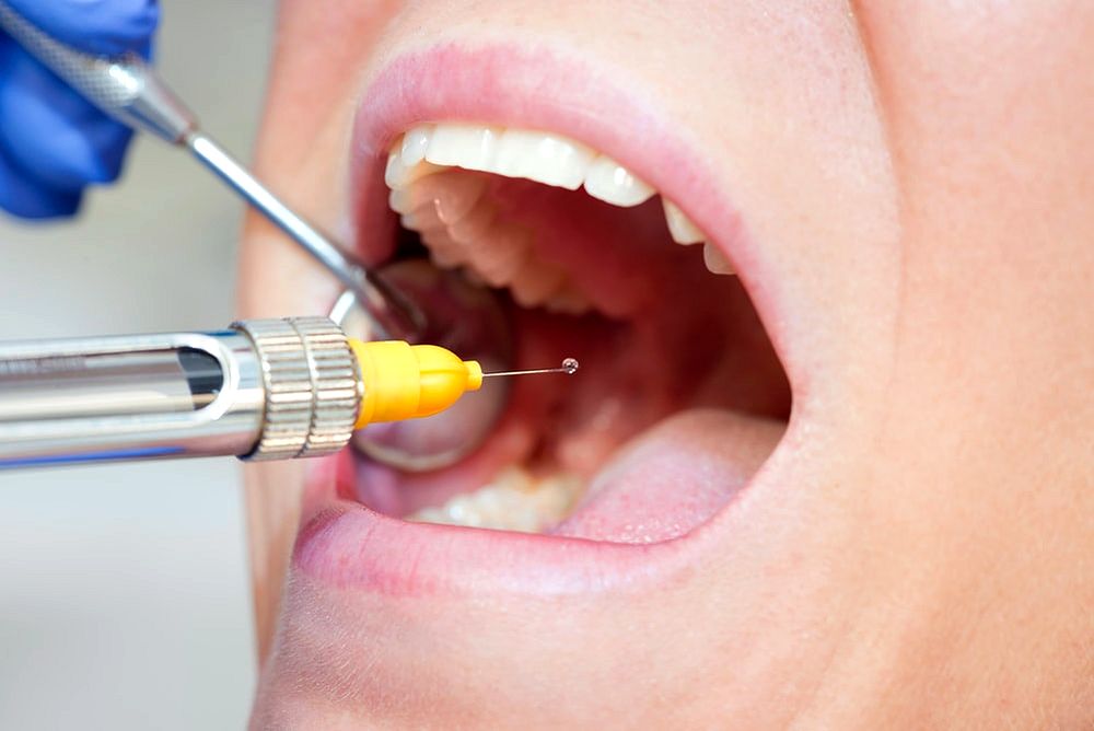 INFOPACIENTE: La Anestesia Dental y sus recomendaciones