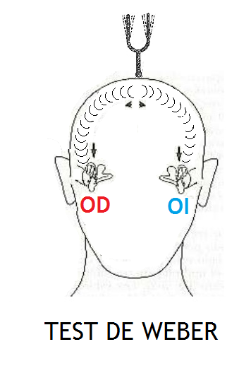 Acumetría Fónica e Instrumental: Test de Rinne y Test de Weber ...