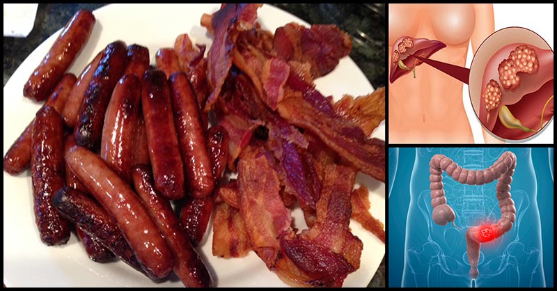 Sausage And Bacon Products Cause Diseases Like Cancer – Health Experts ...