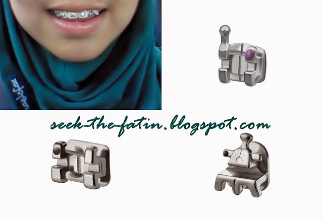Fatin Adibah: step sebelum pakai braces (in details) part II