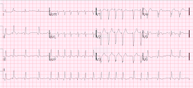 Blog Archives - laderkite