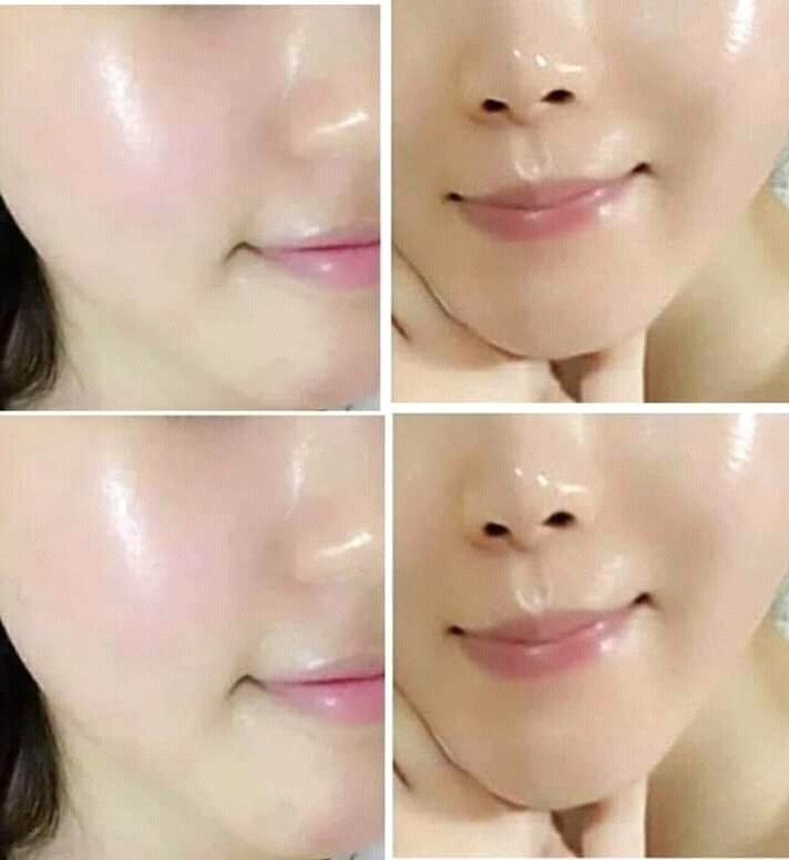 Glass skin natural treatment