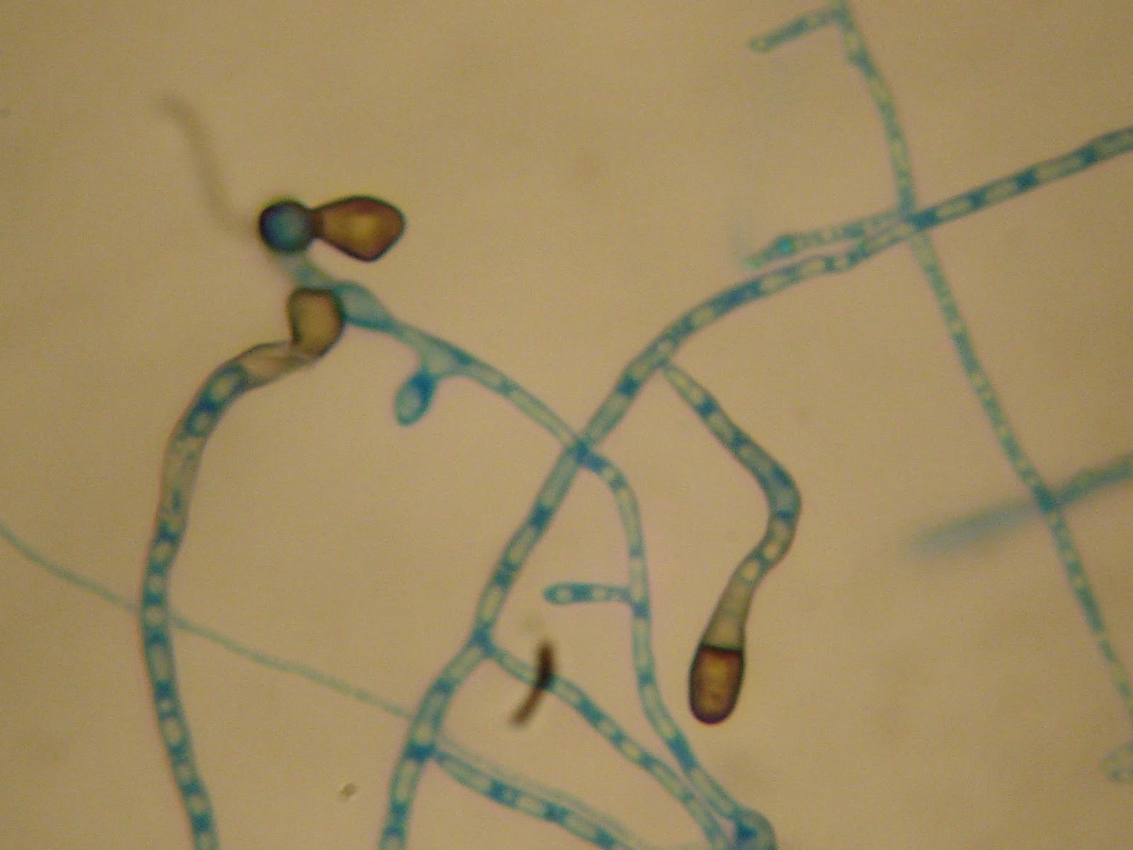 Árvores e Fungos: [Fungos] Gênero: Colletotrichum