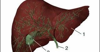 Halamang Gamot (Herbal Medicine): Gallstone Removal (no operation ...