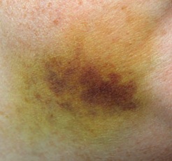 Creating Wonder - the Petrosains Blog: Kenapa Lebam Ada Pelbagai Warna?