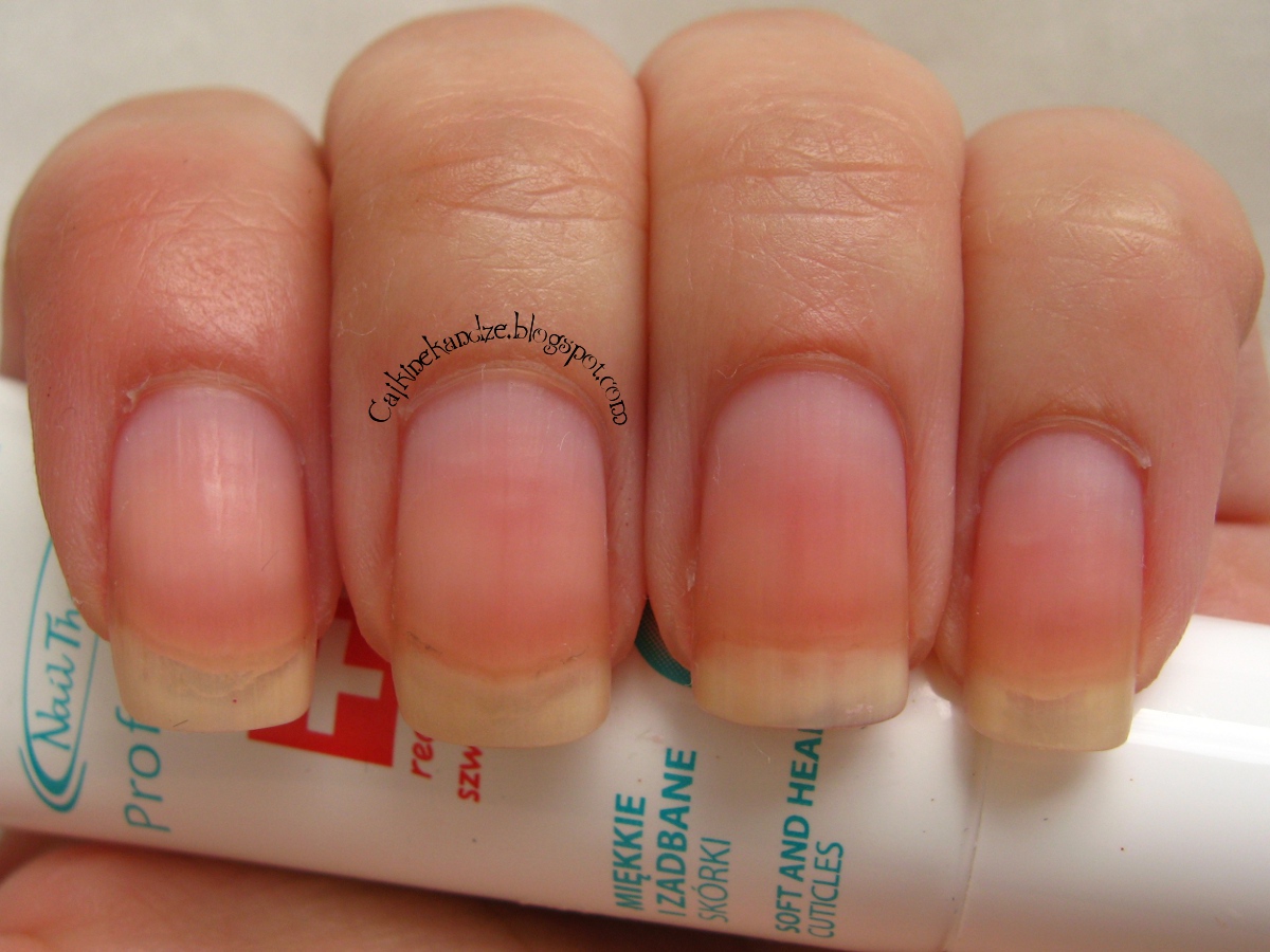 Eveline sredstvo za uklanjanje zanoktica | Cajkine kandže i sve njihove ...