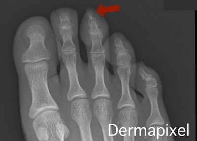 Dermapixel: abril 2021