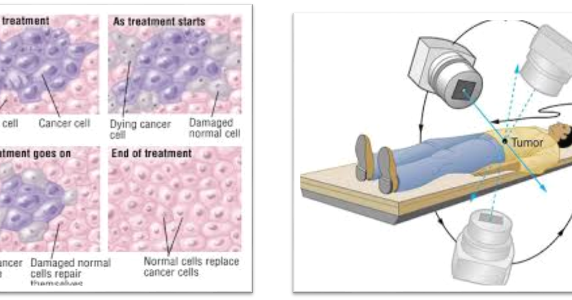 Image Processing - Image sources: Gamma-Ray Imaging