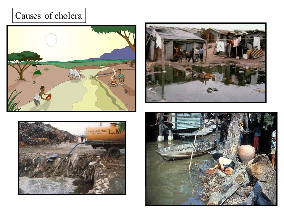 Cholera: Signs and Symptoms Of Cholera - Medical Yukti