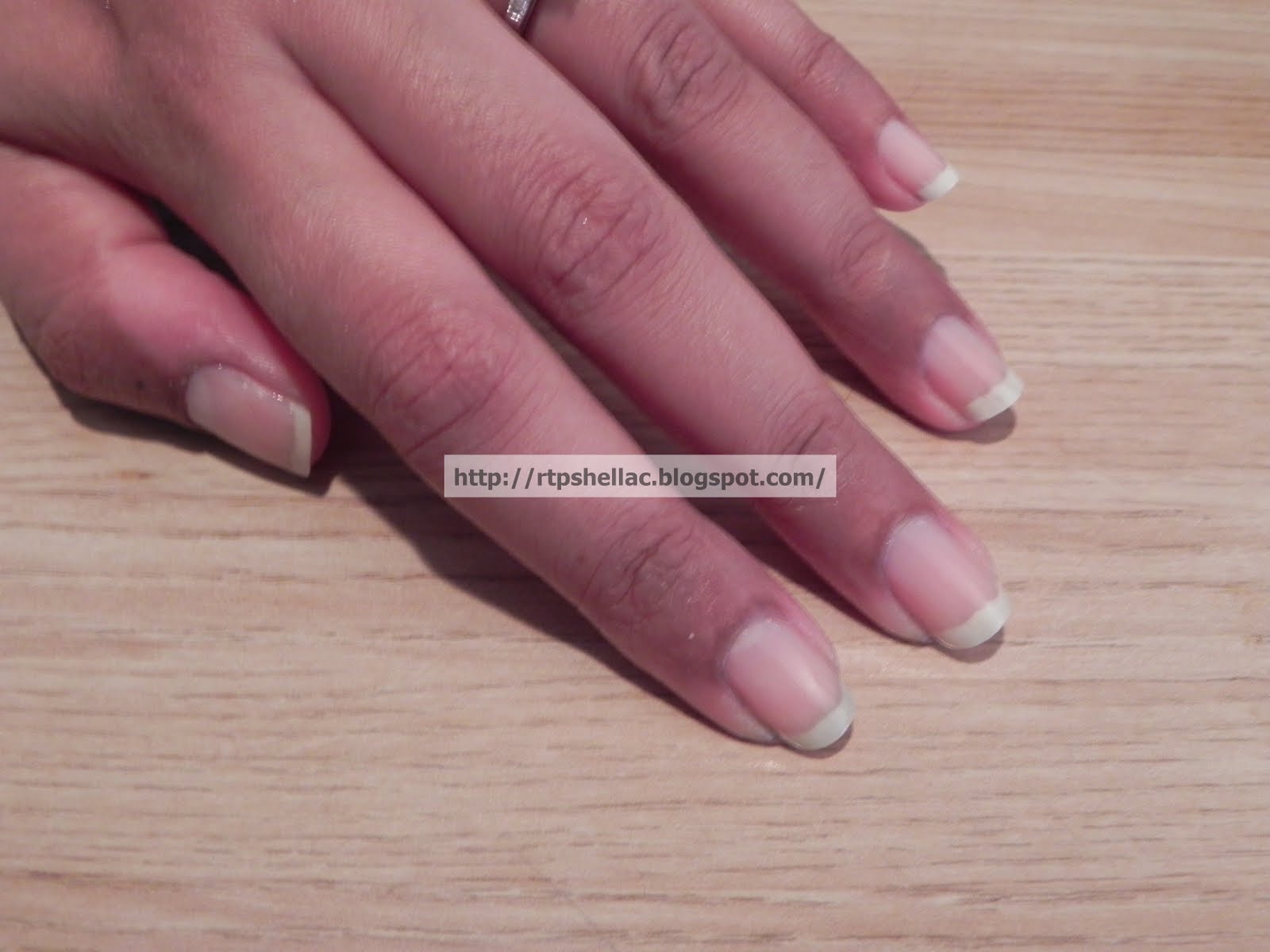 RTP Shellac