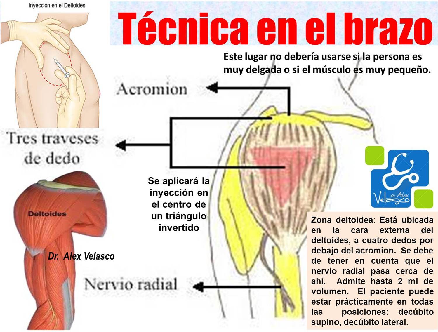 Como Aplicar Una Inyeccion Intramuscular En El Brazo Aplican Compartida ... Como Aplicar Una Inyeccion Intramuscular En El Brazo Aplican Compartida ...