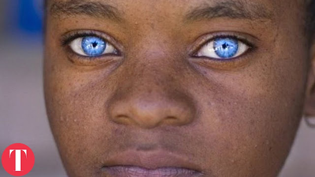 Les 10 personnes noirs avec les plus beaux yeux du monde ! | KaoloMag