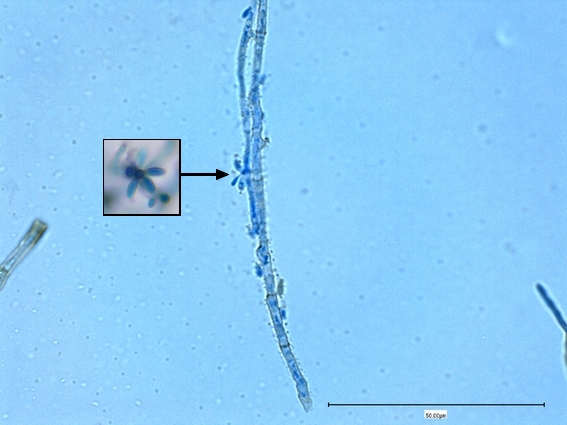 Fun With Microbiology (What's Buggin' You?): Fonsecaea pedrosoi/monophora