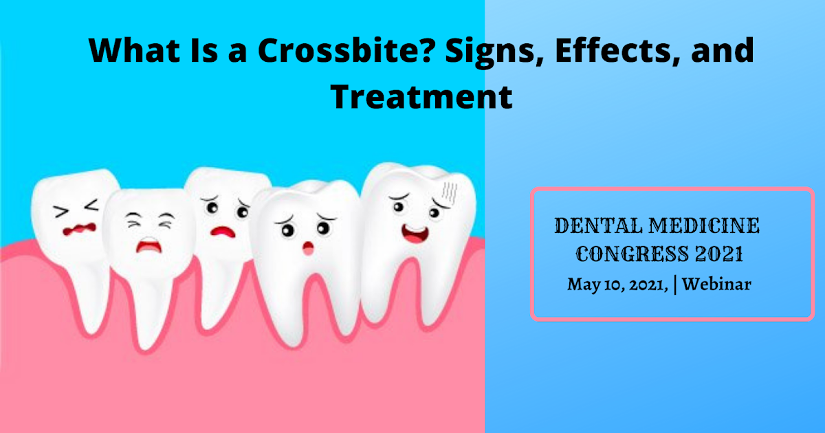 What is a Cross bite? Signs, Effects, and Treatment