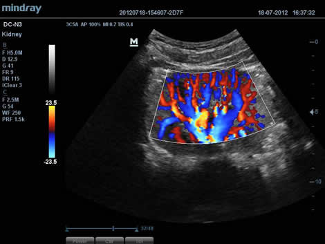 USG 4 Dimensi DC-N3 PRO Mindray, USG 4D Terbaik dan Tercanggih ...
