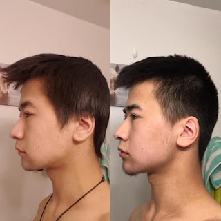 Healing Arts NYC: The Art of Mewing