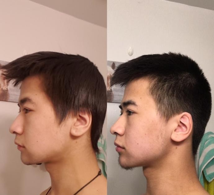 Healing Arts NYC: The Art of Mewing