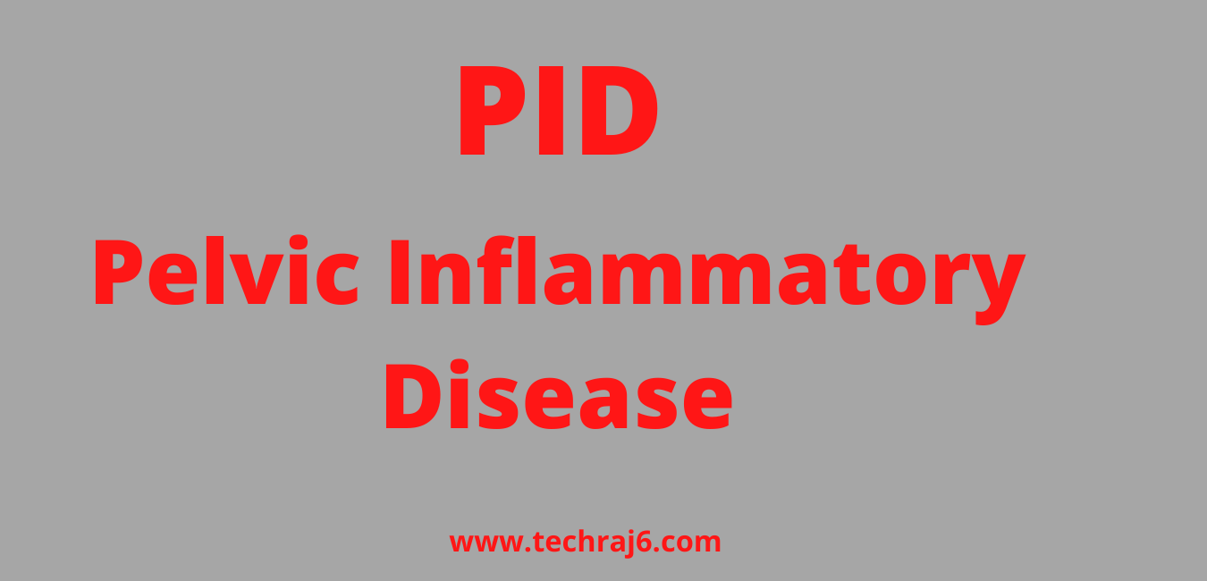 PID full form, What is the full form of PID