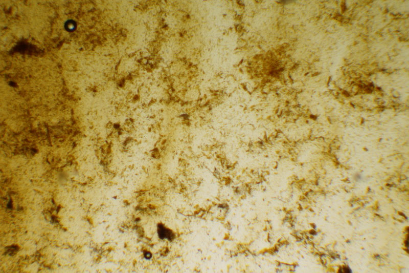 El mundo microscópico de los hongos: Pisolithus arhizus (Scop.per Pers ...