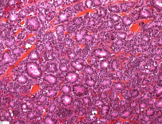 Extended Practice : Pink Ink || Pink cells || Image inspiration