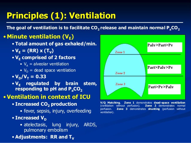 MV (MECHANICAL VENTILATOR) SETTINGS,MAKE EASY