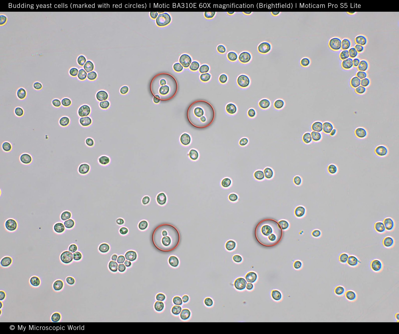 Motic Europe | Blog: Yeast - The helpful and harmful organism
