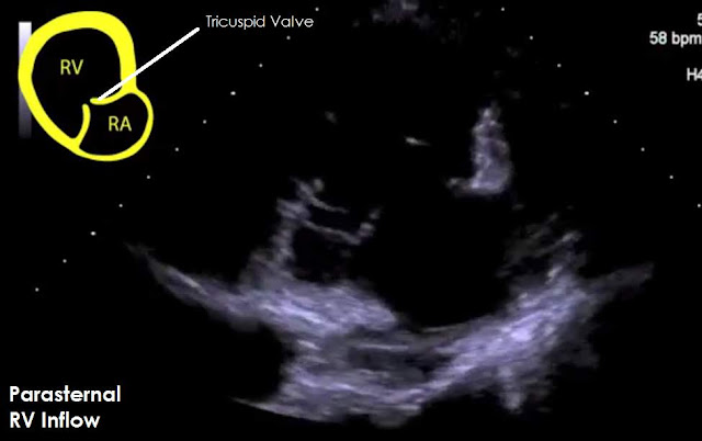 Learn Echocardiography | Standard Protocol for Performing Comprehensive ...