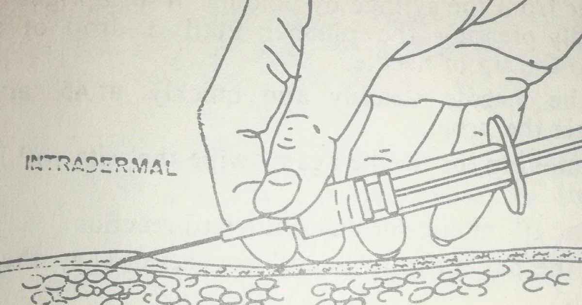 INTRA DERMAL INJECTION