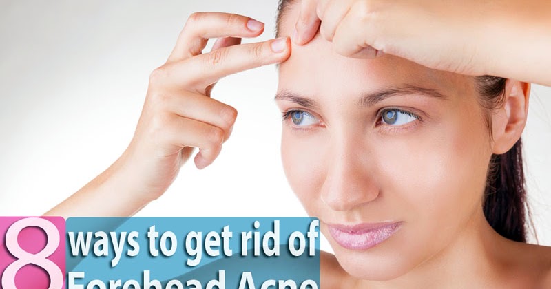 8 Ways to Get Rid of Forehead Acne Overnight ~ ACNE BEFORE AND AFTER ...