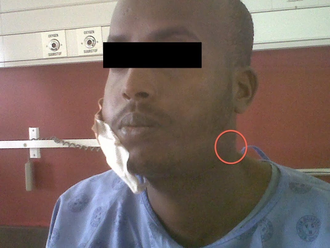 Trauma surgery in Cape Town: December 2012